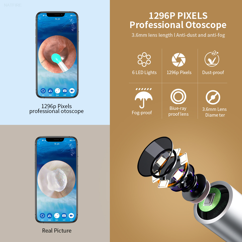 Smart Visual Ear Otoscope Endoscope Wax Removal Tool - HUS Enterprises LLC